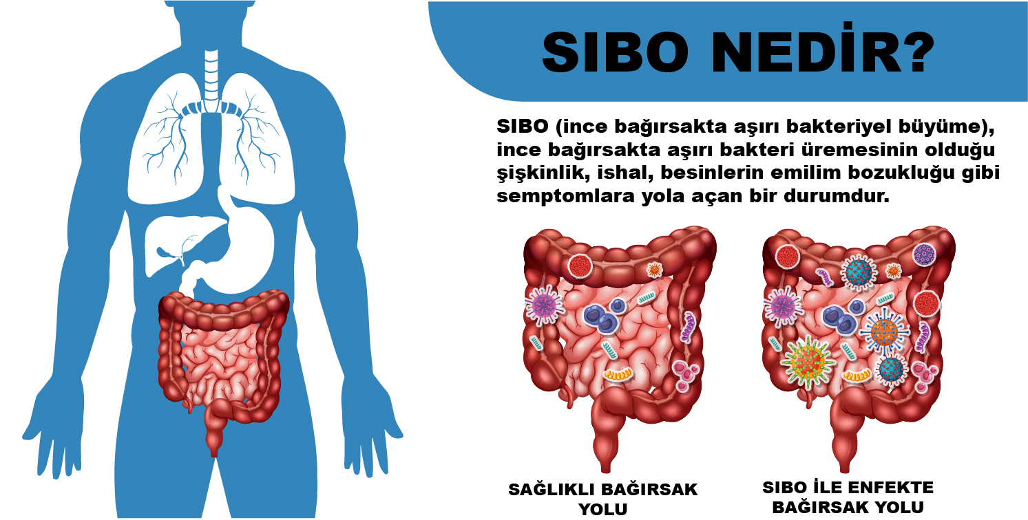SIBO Nedir?